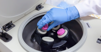 Centrifuge Top Tips Part 2 - Correct Use and Safety - Richmond Scientific